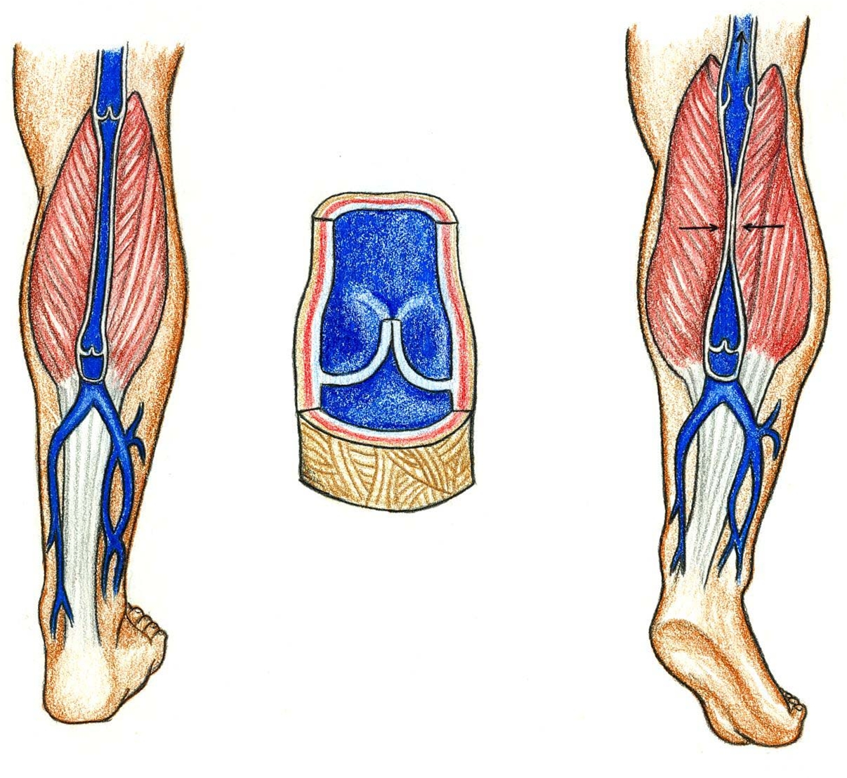 Venøse bensår - Patienthåndbogen på sundhed.dk