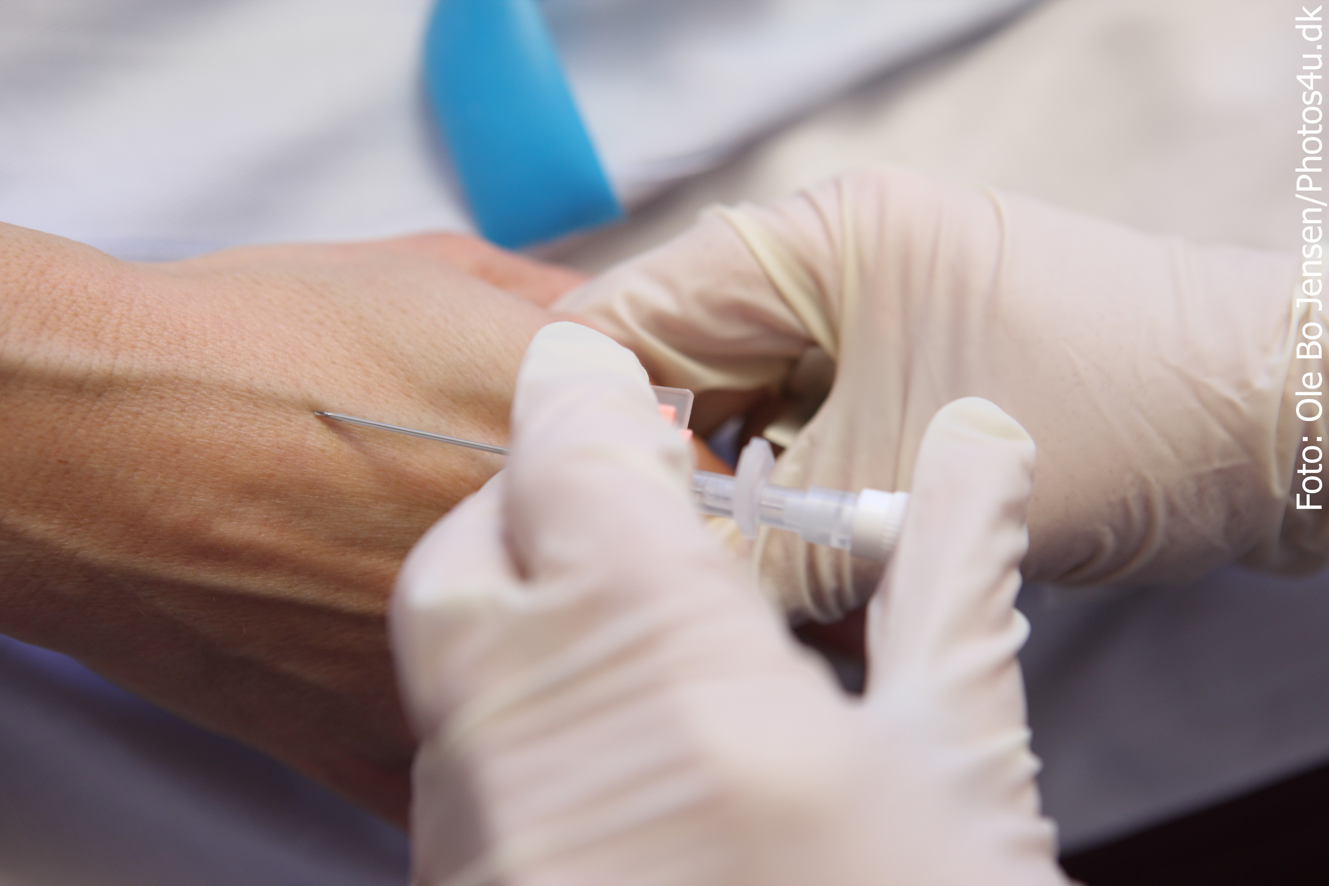 Anæstesi, kort oversigt - Patienthåndbogen på sundhed.dk