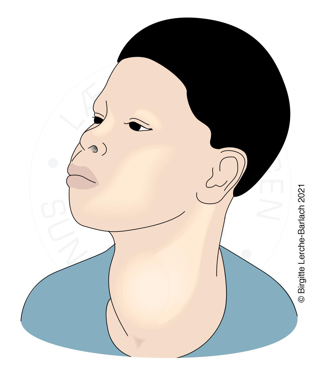 Knudestruma - Patienthåndbogen på sundhed.dk