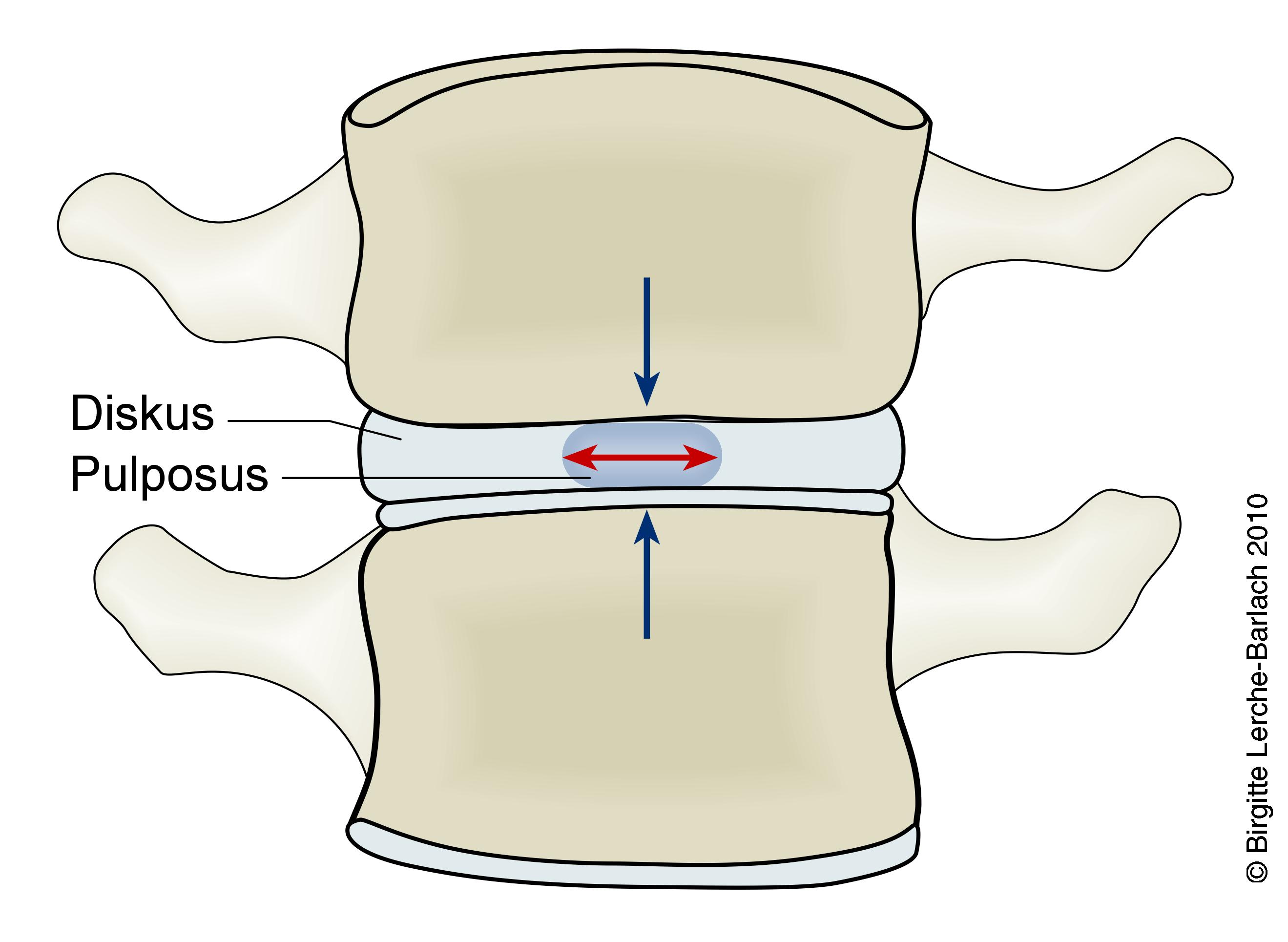 Diskus med kompression - Patienthåndbogen på sundhed.dk