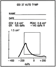 Tympanogram, mindre undertryk - Patienthåndbogen på sundhed.dk