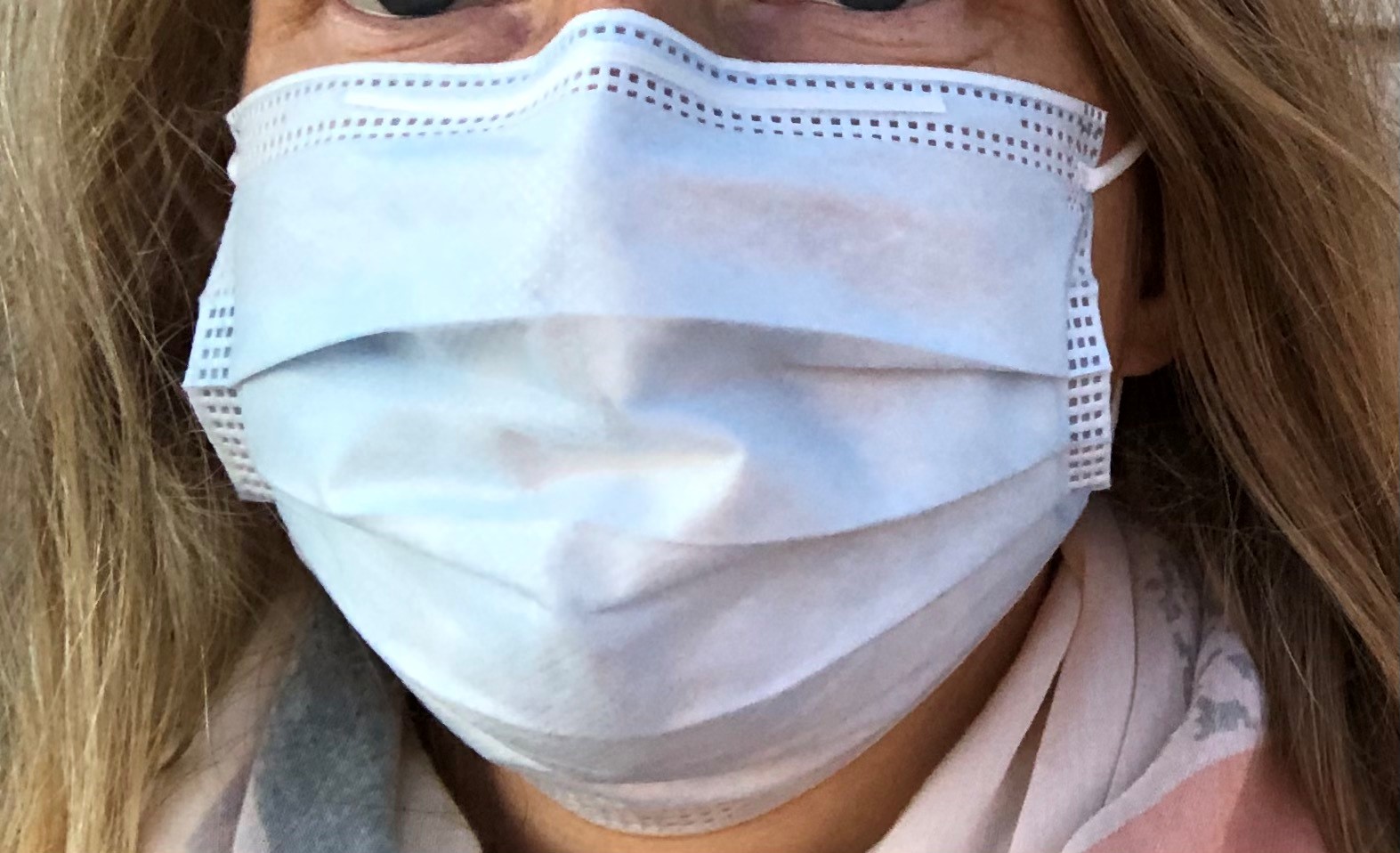 Udslæt, der skyldes mundbind - Patienthåndbogen på sundhed.dk