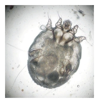 Scabies/fnat - Lægehåndbogen på sundhed.dk