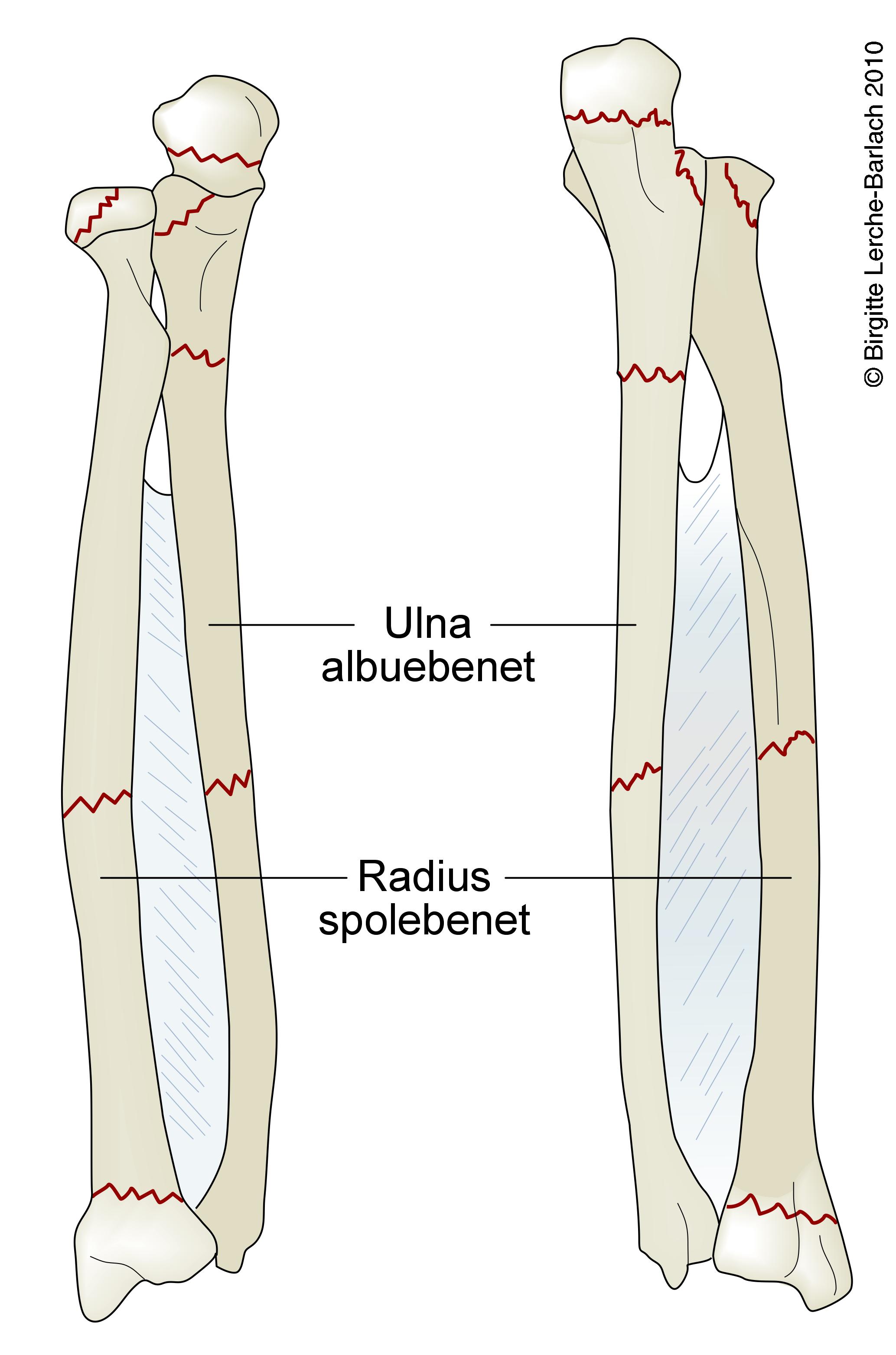 Radius og ulna, brud - Patienthåndbogen på sundhed.dk