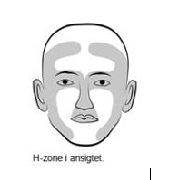 Visitation af nonmelanom hudkræft (BCC og PCC) - sundhed.dk